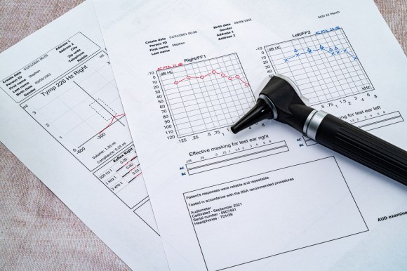 Beyond the Circles and Crosses: Understanding Your Audiogram – Sudden ...
