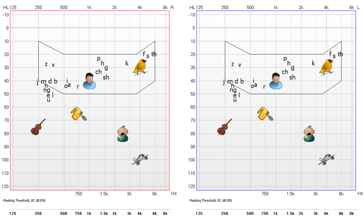 Beyond the Circles and Crosses: Understanding Your Audiogram – Sudden ...